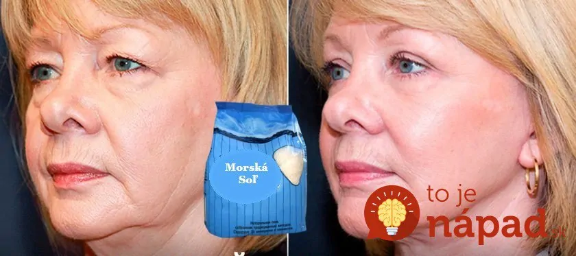 Kozmetička poradila, ako používať morskú soľ spôsobom, o akom sa nám ...