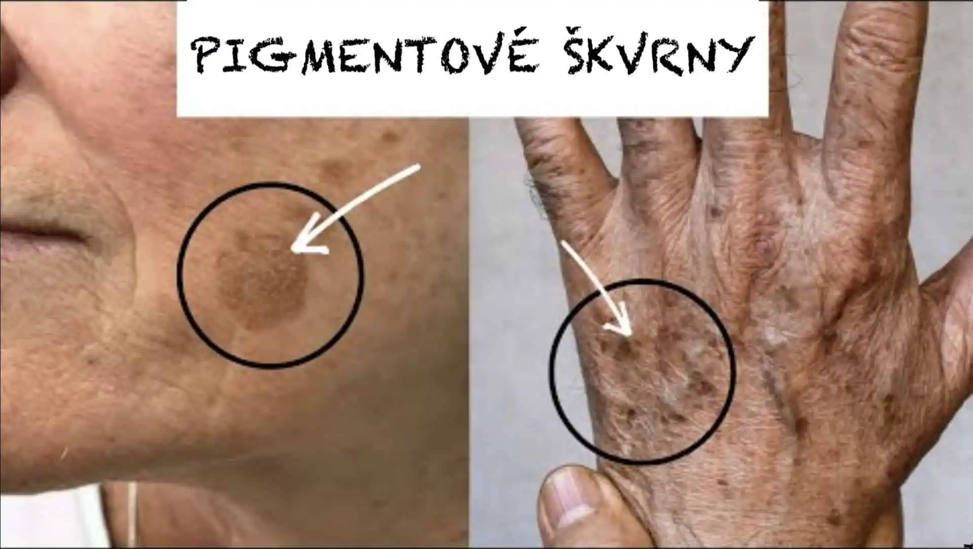 Už žiadne pigmentové škvrny: Tento minerál je darom z nebies!