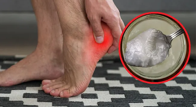 Ako sa zbaviť pätovej ostrohy? Vyskúšajte prírodnú zmes!