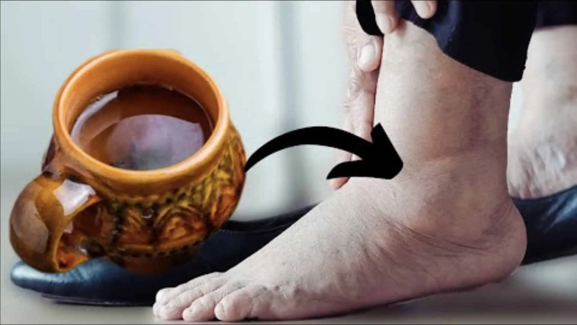 ČAJ, ktorý ma naučila robiť svokra okamžite odstraňuje opuch nôh ...